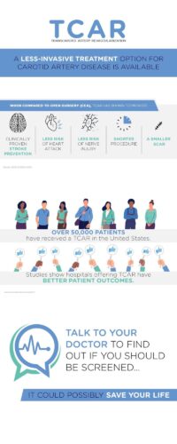 TCAR Surgery Chattanooga Stroke Prevention Procedures | USA