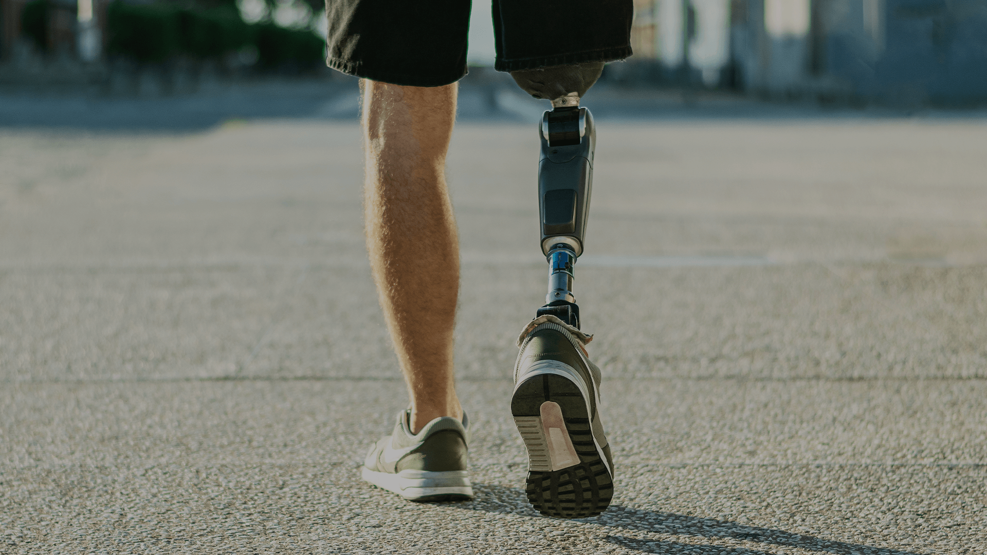 Prosthetic Services - University Surgical Associates